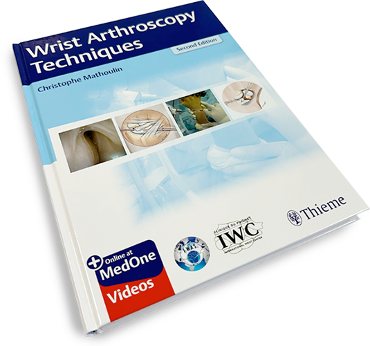 Dutch Wrist Arthroscopy.